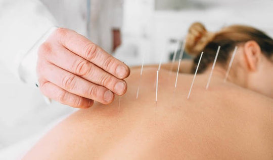Reduce Pain During Periods with Acupuncture for Womens Health Brooklyn ...